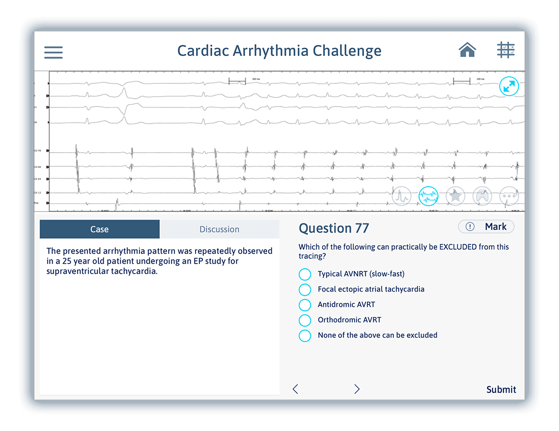 Cardiac Arrhythmia Challenge - CorXL | Advanced cardiac device training
