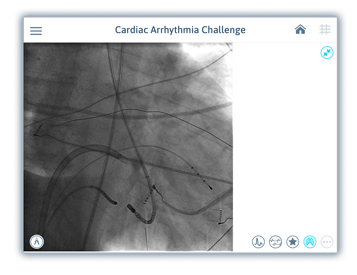 Cardiac Arrhythmia Challenge - CorXL | Advanced cardiac device training